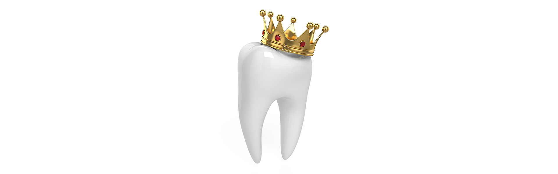 Are Metal Crowns Still Used? When and Why They’re Recommended
